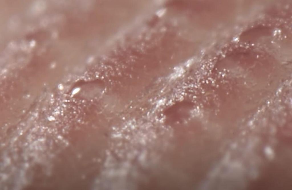 Ini Rupa Peluh Yang Keluar Dari Kulit Di Bawah Mikroskop